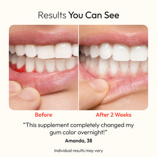 Gum Restore Supplement - Gum Resilience Formula, Whole Food Supplement ...
